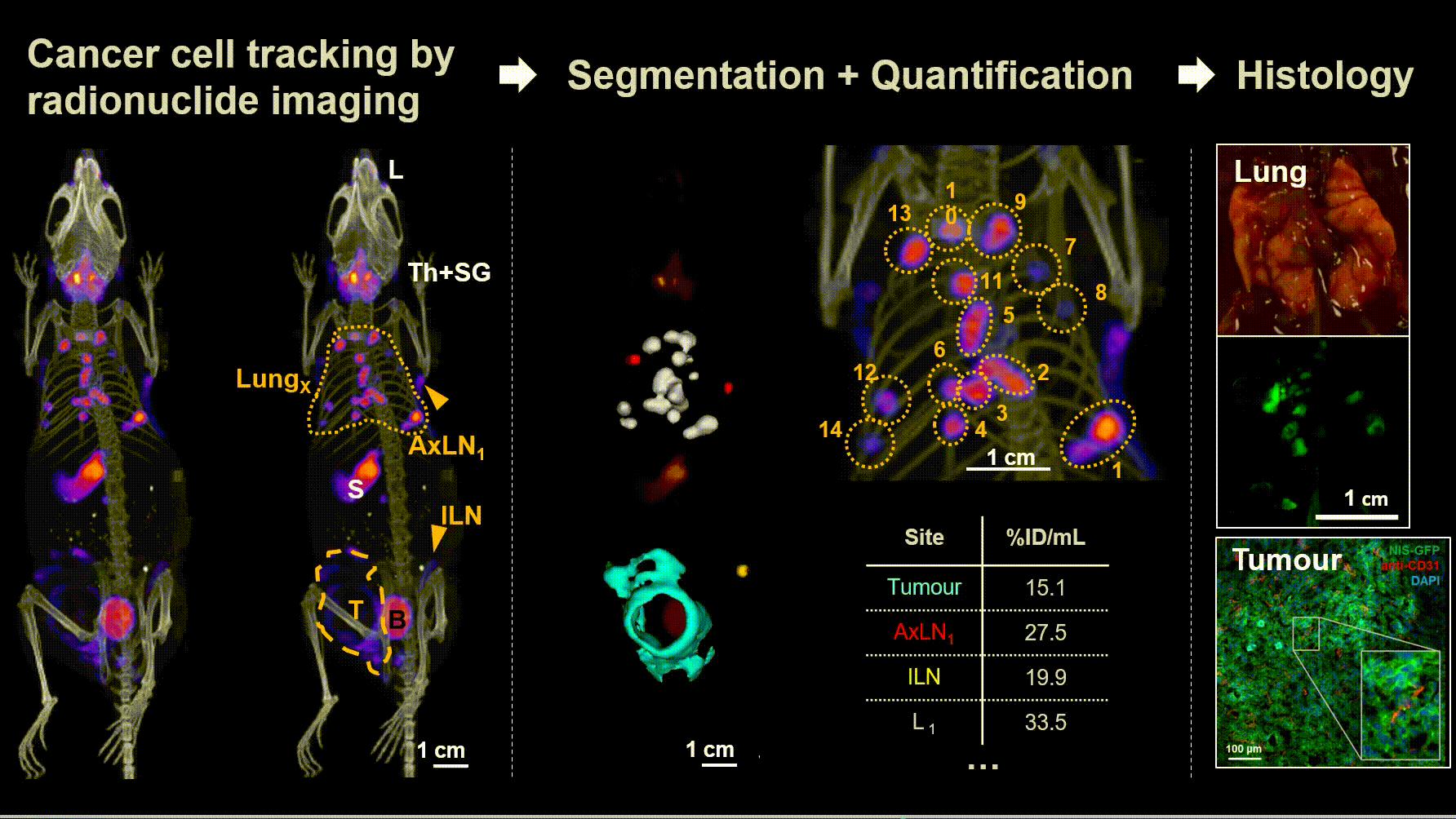 Cancer Progression and Metastasis – The Fruhwirth Lab
