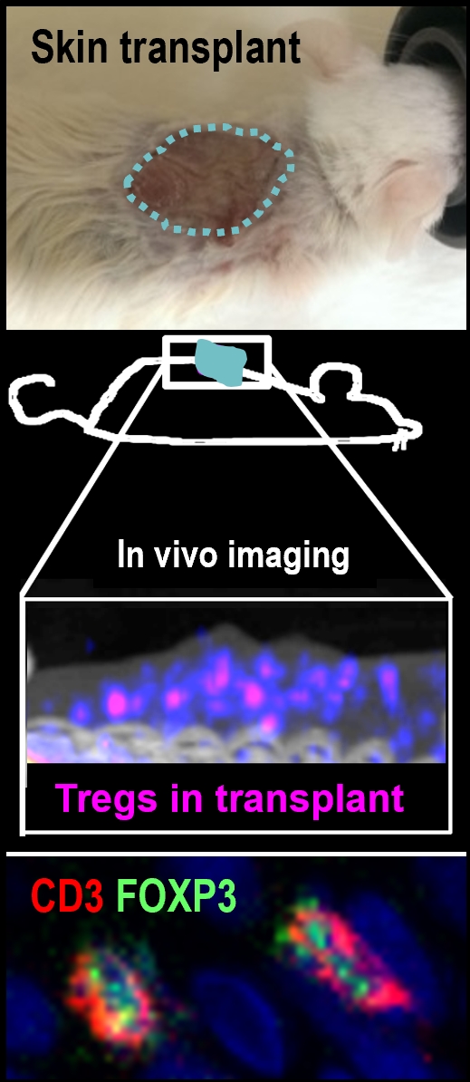 Engineering Cell Therapies – The Fruhwirth Lab